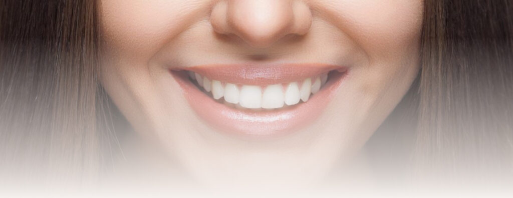 Composite stratifié | Cabinet dentaire du Dr Juliana Galan